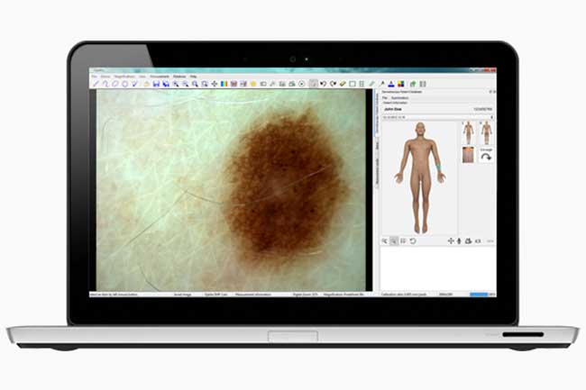 dermatologists-mole-mapping - Specialist Dermatologists